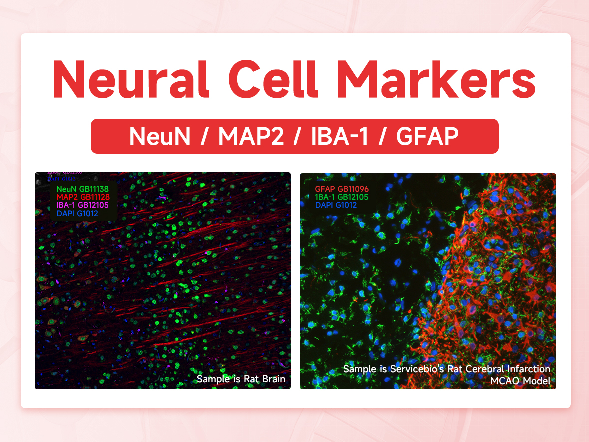 Servicebio Biological | Products _Servicebio_ Wuhan Servicebio ...