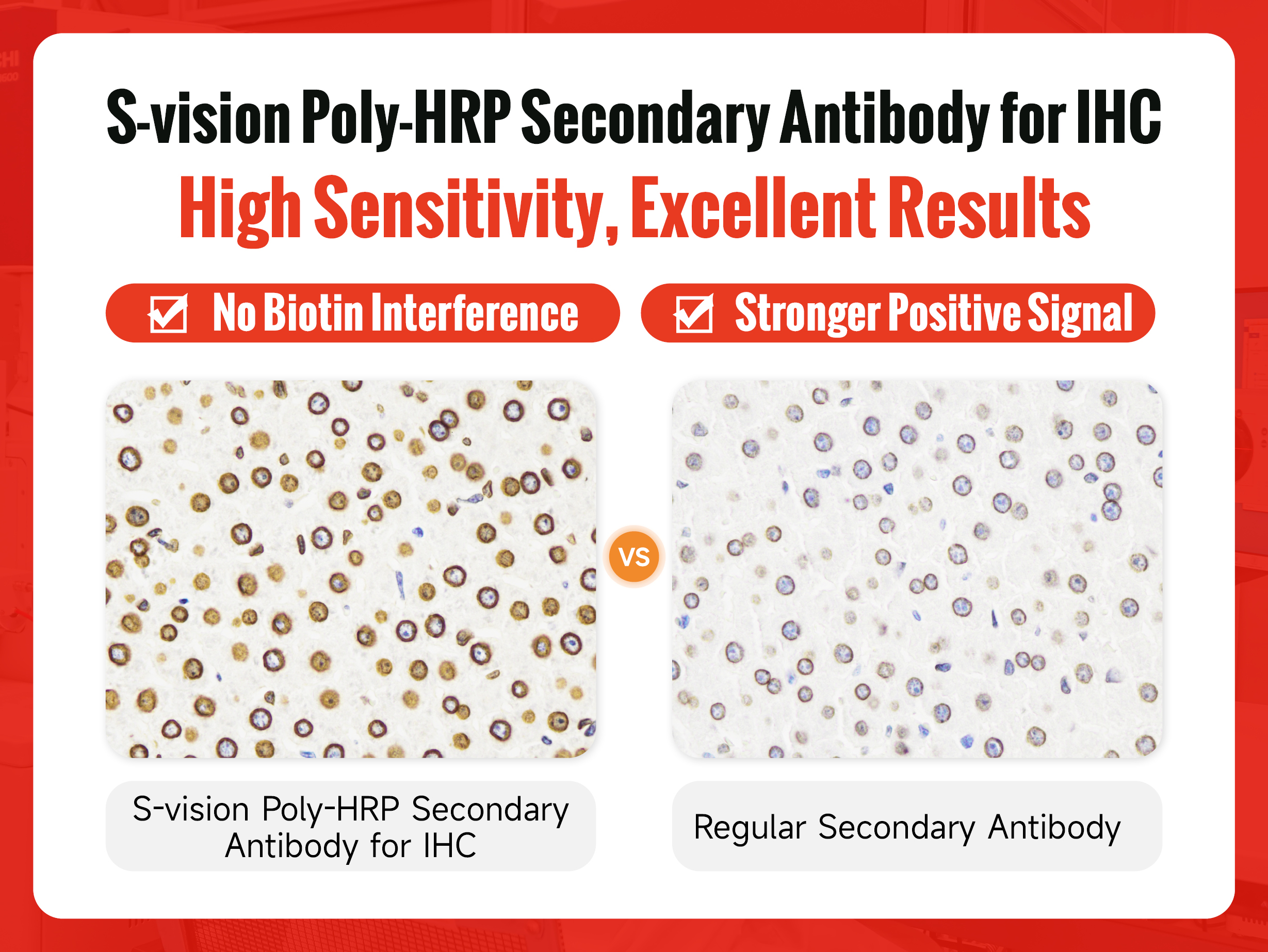 Servicebio Biological | Products _Servicebio_ Wuhan Servicebio ...