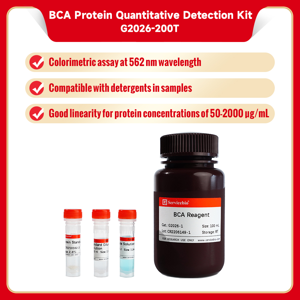 Servicebio Biological | Products _Servicebio_ Wuhan Servicebio ...